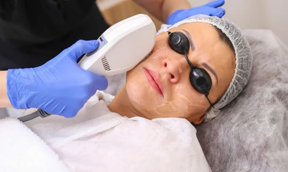 How IPL Laser Treatment Reduces Sun Damage and Age Spots